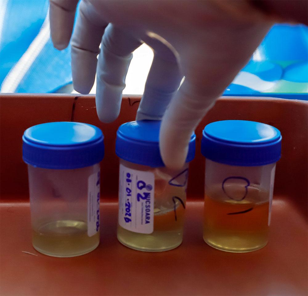 Mobile drug-testing program begins for public transport drivers ...