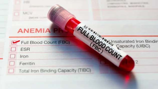 Medical laboratory fined Rs. 500,000 for overcharging FBC test report ...